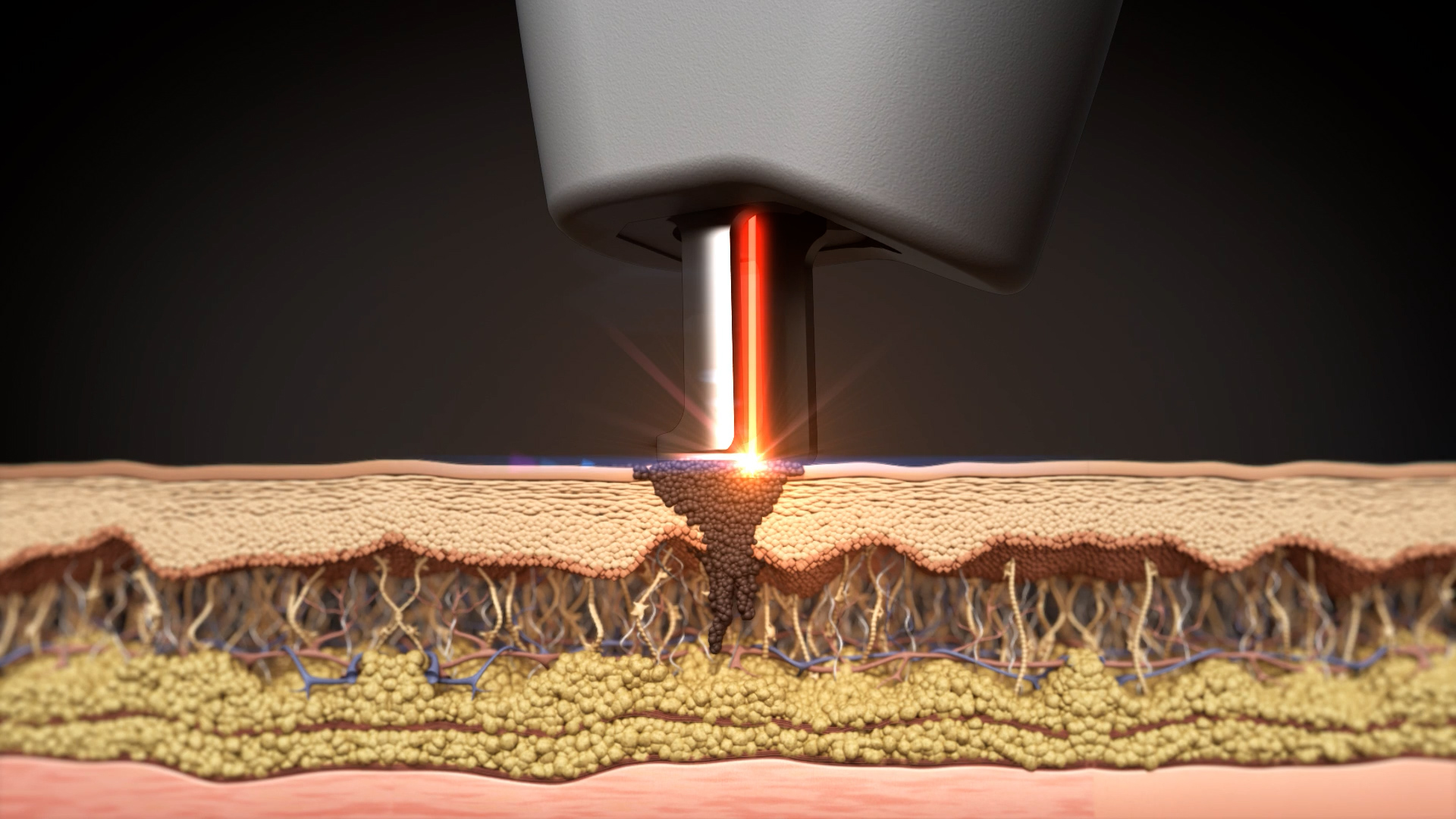 스페클립스 3D 홍보영상1,200만 원 ｜ 2주 – ROCKETBOOST